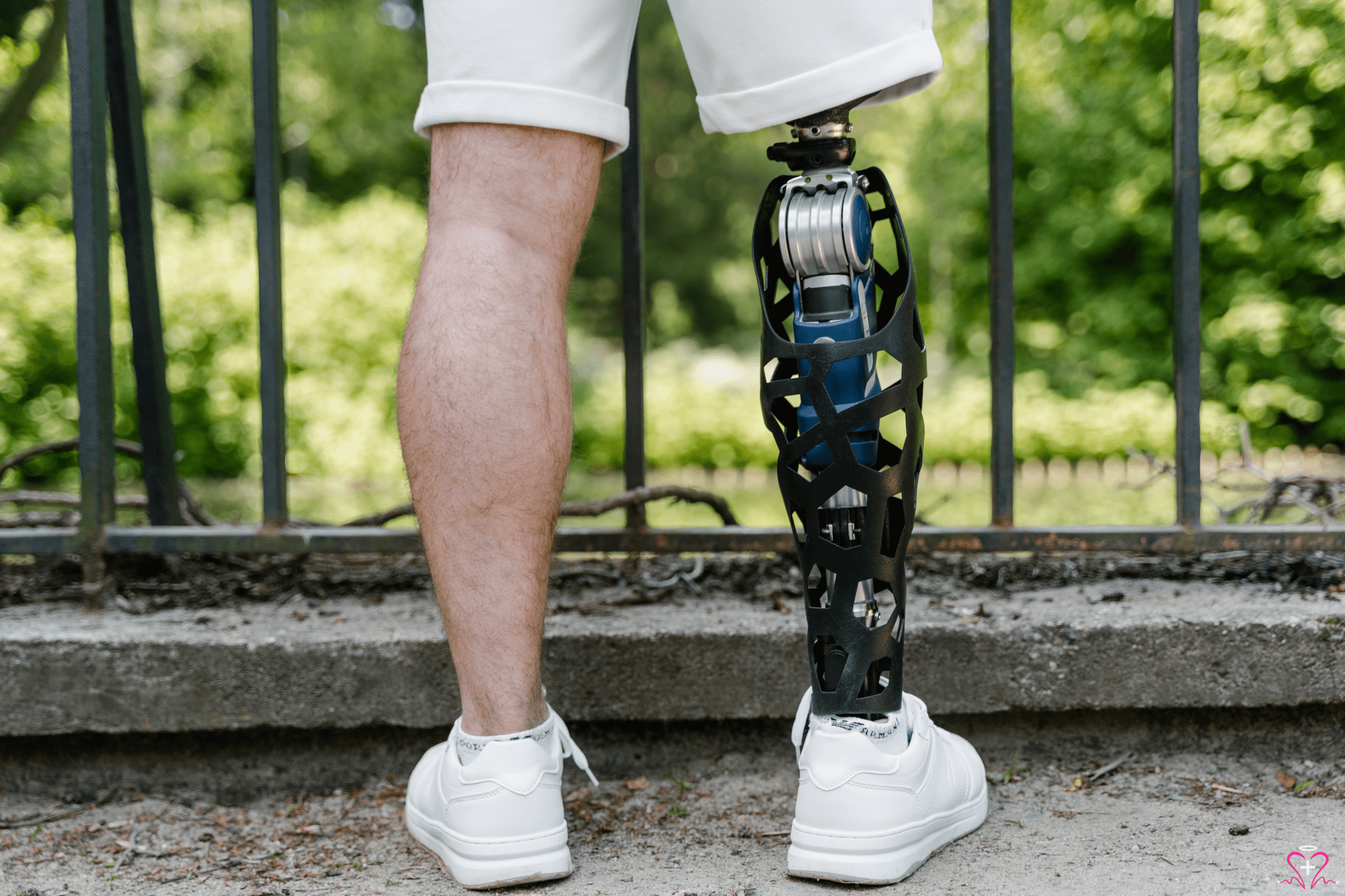 Exploring the Different Types of Prosthetics