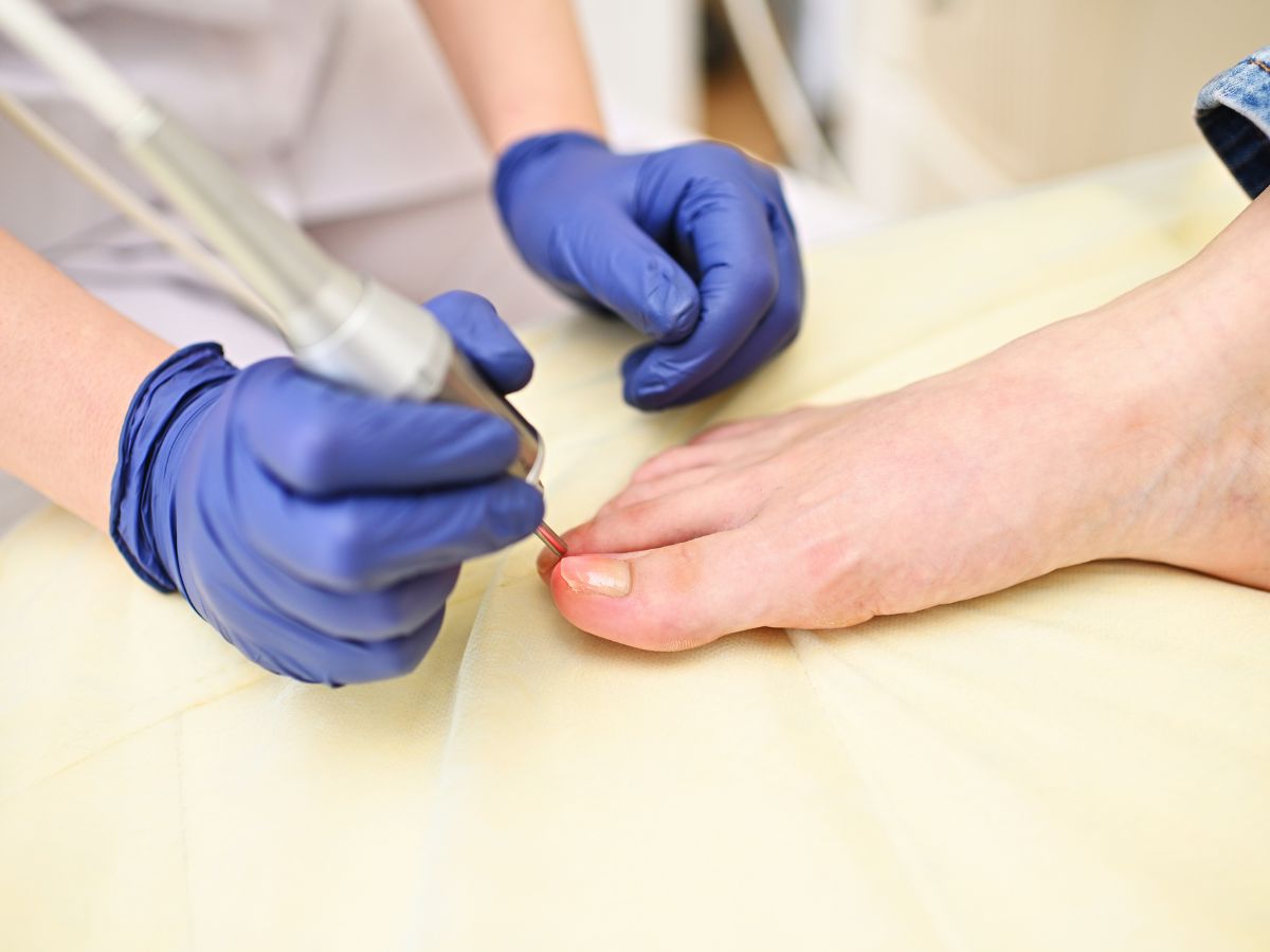 Nail Fungal Testing for Seniors | All Seniors Foundation