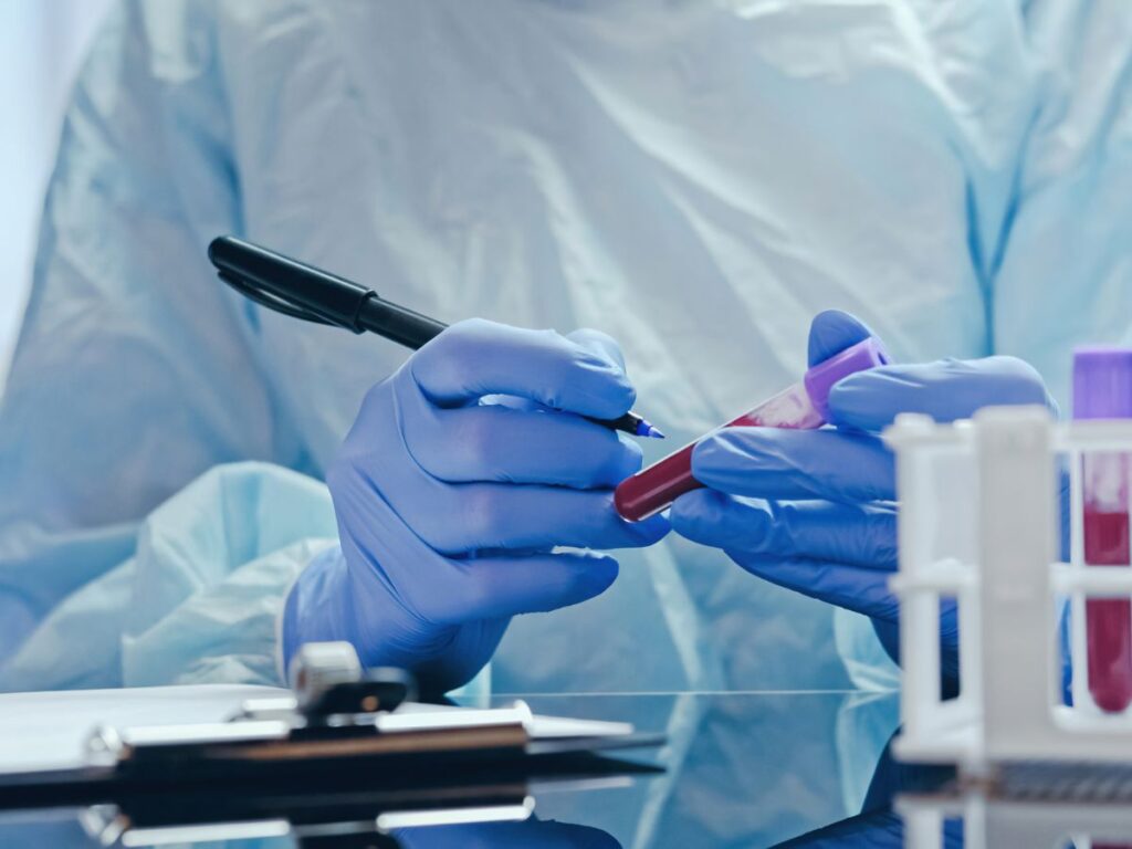 Understanding the Hepatic Function Panel: Interpreting Results