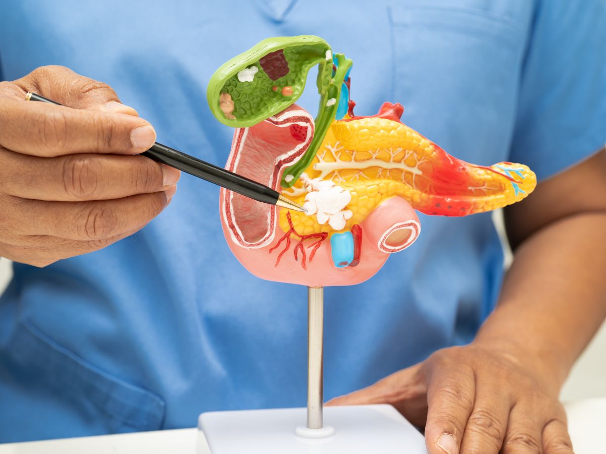 Pancreatic Cancer: Curability & Treatment