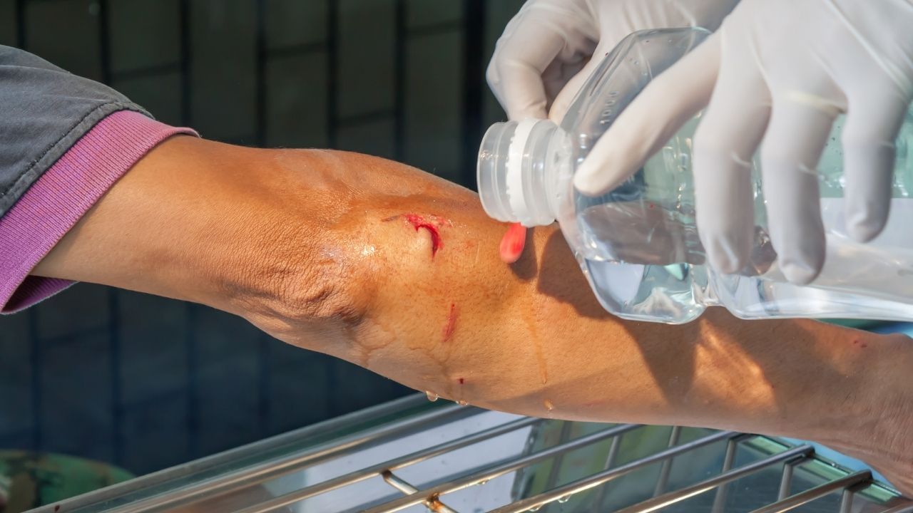 El mejor ungüento para heridas abiertas: Guía para personas mayores 2025