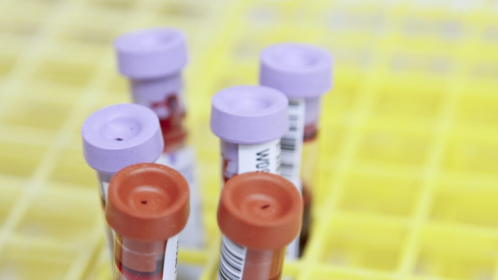 Best Home Therapies for Elderly Seniors: Caregiver Guide 2026