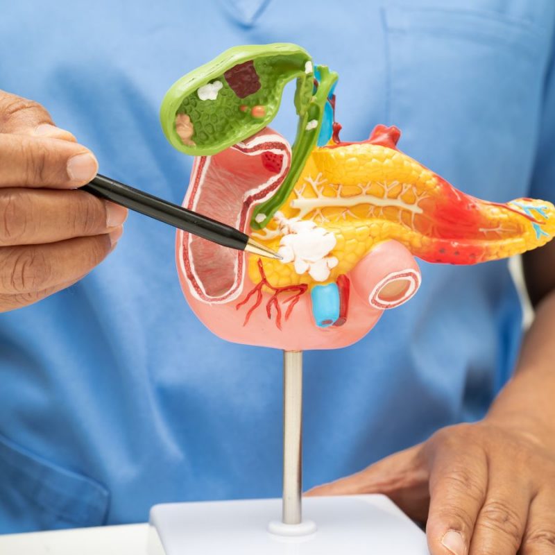 Pancreatic Cancer: Understanding Symptoms and Risks